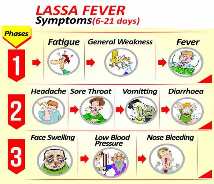 Lassa Fever- Causes, Symptoms, Treatment, Diagnosis and Prevention ... Lassa Fever- Causes, Symptoms, Treatment, Diagnosis and Prevention ...